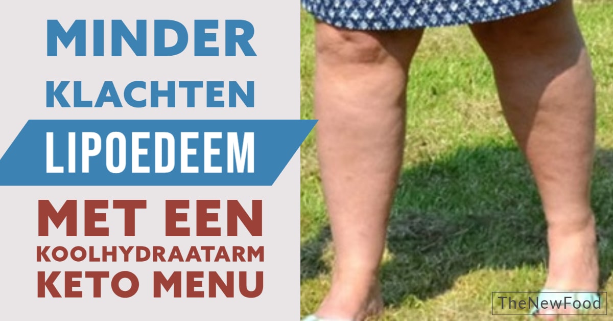 Lipoedeem of Lymfoedeem en keto - Lipoedeem of Lymfoedeem en keto